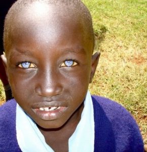 Discover why some blacks have natural blue eyes – Afroculture.net