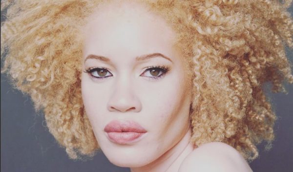 9 hairstyles ideas for albino women – Afroculture.net