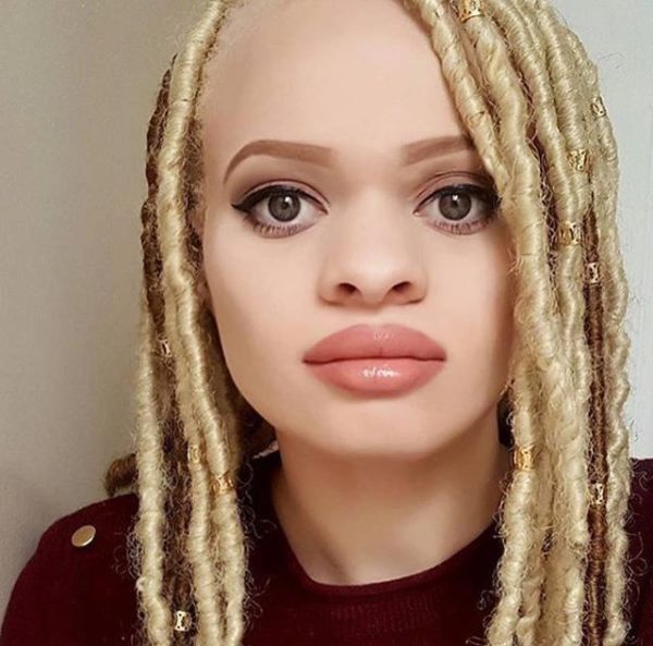 9 hairstyles ideas for albino women – Afroculture.net