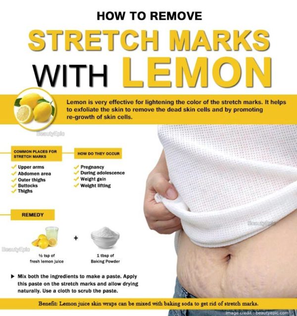 4 benefits of lemon for stretch marks – Afroculture.net